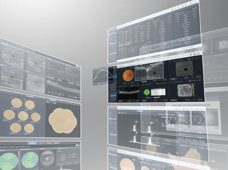 HIIS-1 | Data Integration Management System | Huvitz