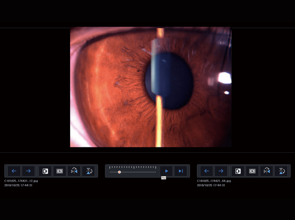 HIS-5000 | Slit lamp ＆ Imaging System | Huvitz