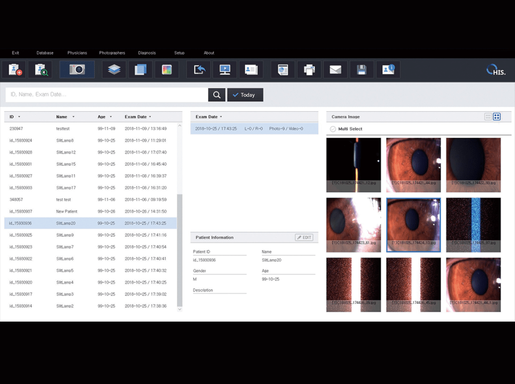 HIS-5000 | Slit lamp ＆ Imaging System | Huvitz