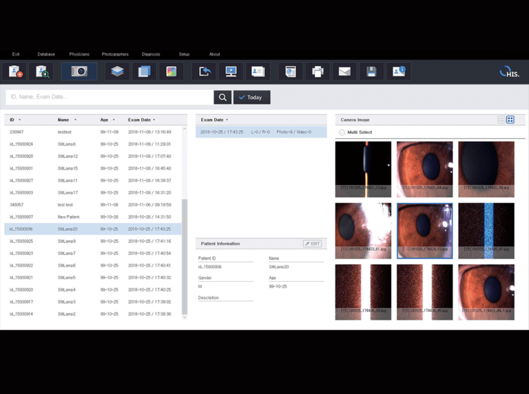 HIS-5000 | Slit lamp ＆ Imaging System | Huvitz