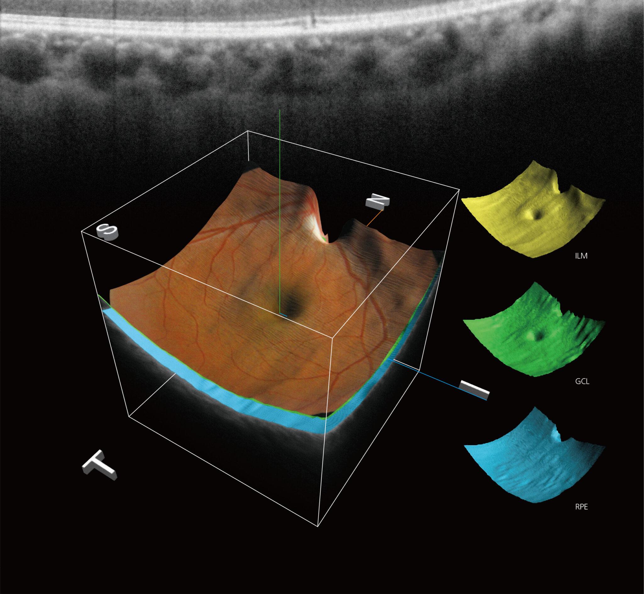 R&D | Science | Huvitz
